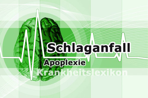 Schlaganfall | Krankheitslexikon » gesund.co.at