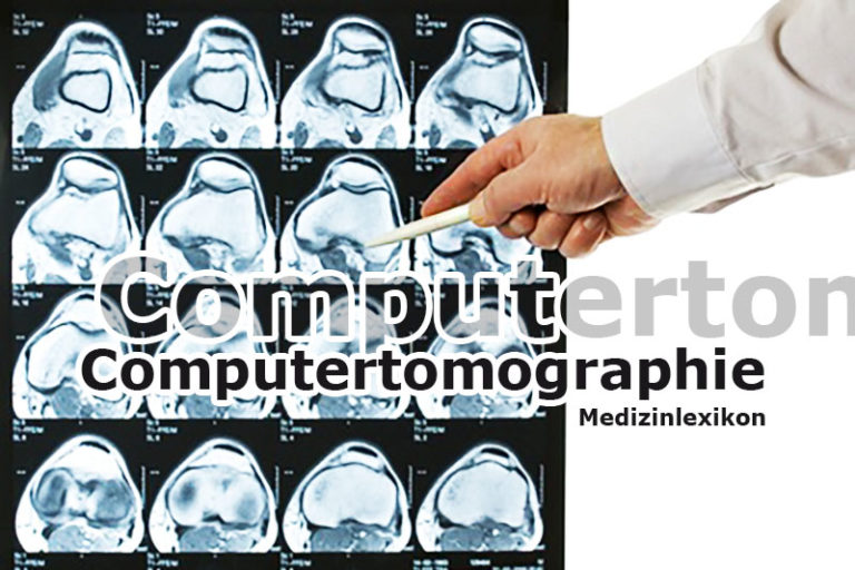 Computertomographie | Medizinlexikon » gesund.co.at